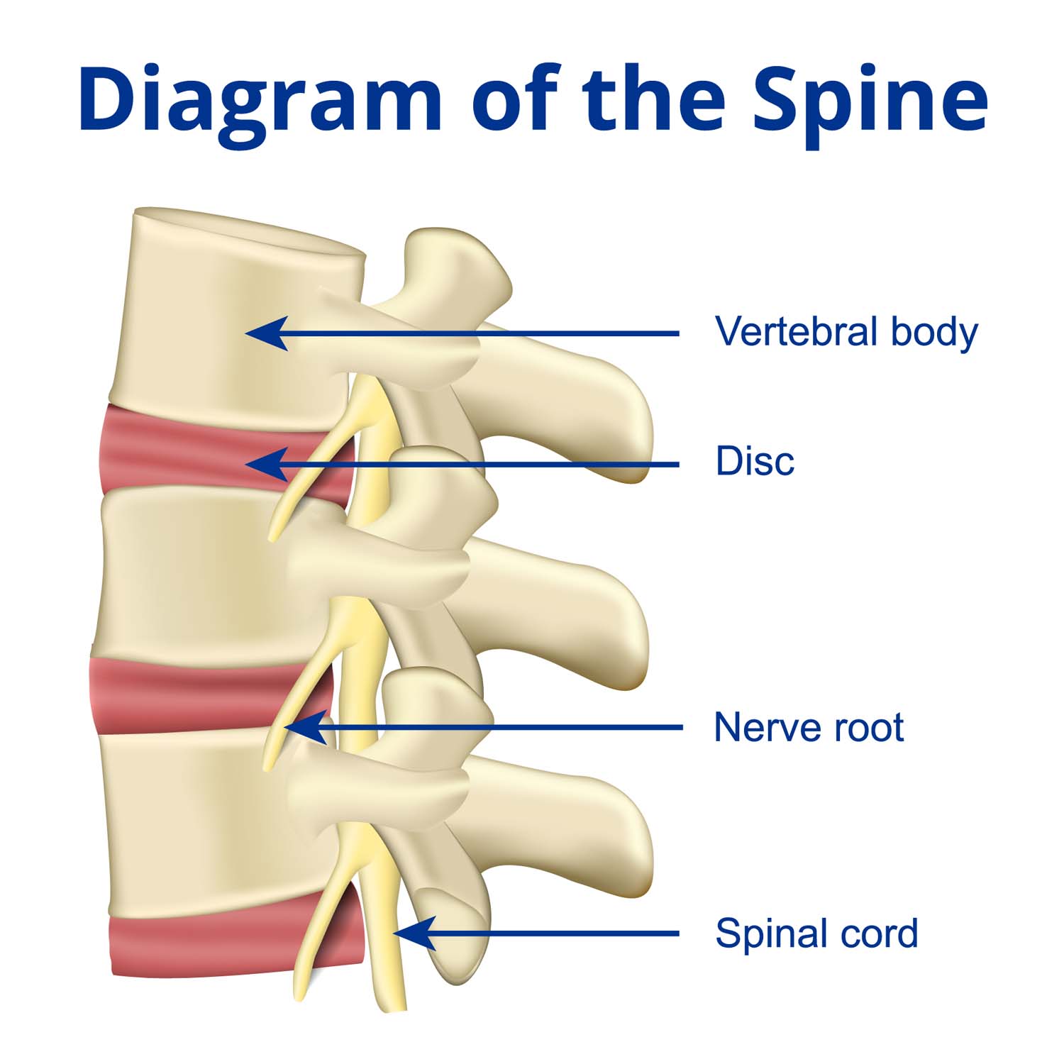 Disc Pain and Injuries - Susquehanna Spine & Rehab