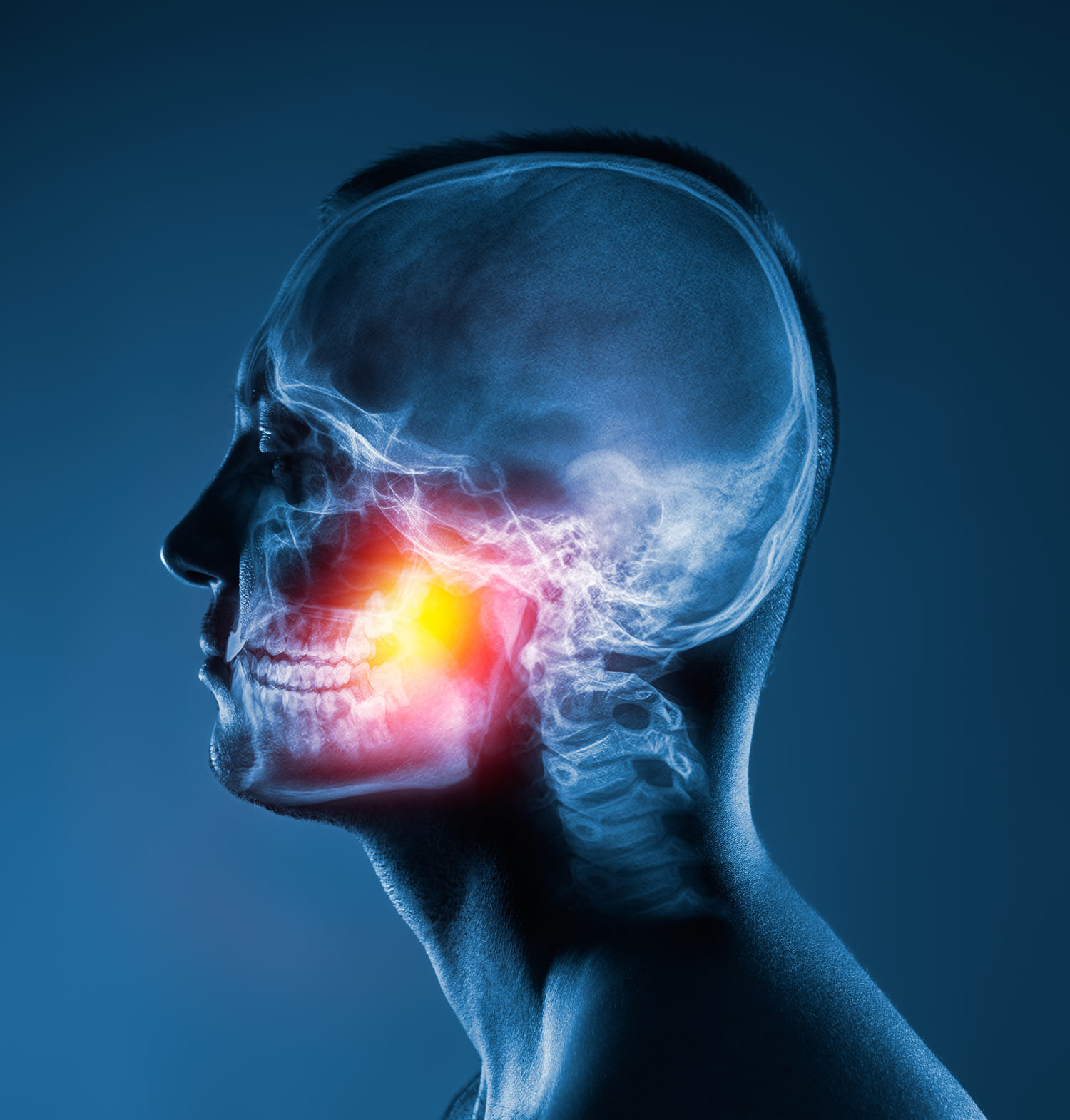 Jaw Pain / TMJ Pain Treatment | Susquehanna Spine & Rehab Jaw Pain / TMJ Pain Treatment | Susquehanna Spine & Rehab