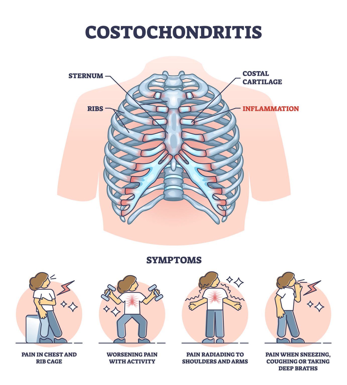 Costochondritis Treatment | Susquehanna Spine & Rehab