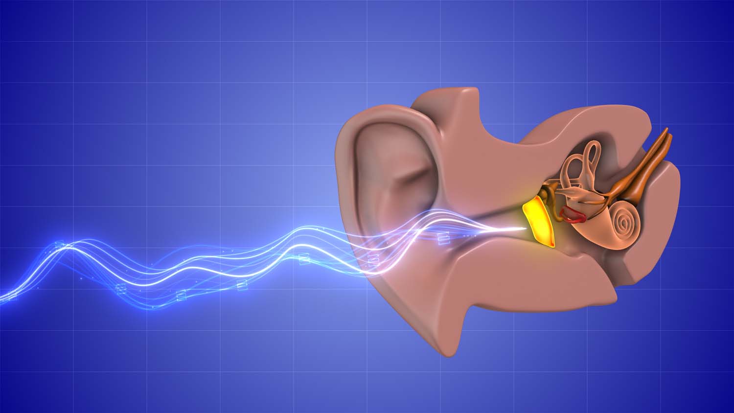 Ringing of the Ears Treatment - Susquehanna Spine & Rehab