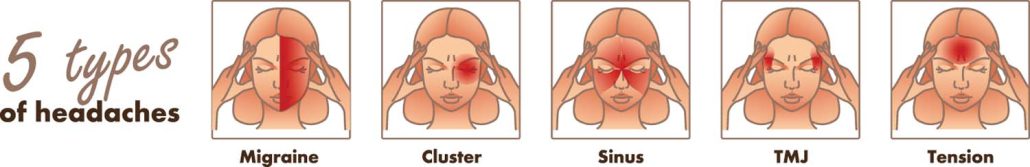 Tension Headache Pain Treatment - Susquehanna Spine & Rehab Tension Headache Pain Treatment - Susquehanna Spine & Rehab