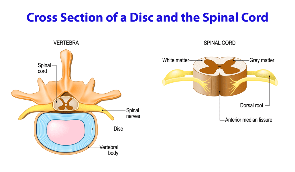 Disc Pain and Injuries - Susquehanna Spine & Rehab